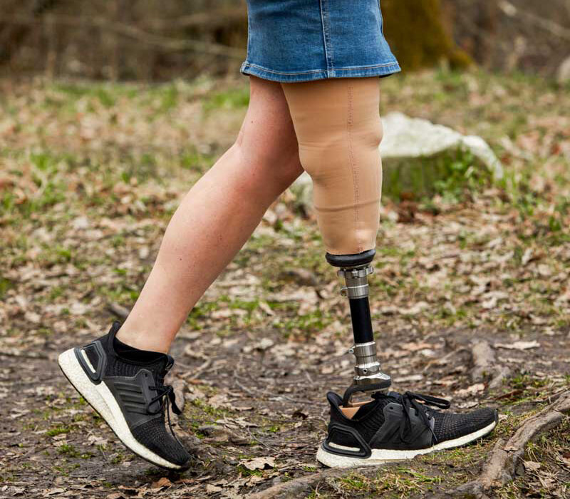 Discover Meracus® Prosthetic Foot | Allard USA