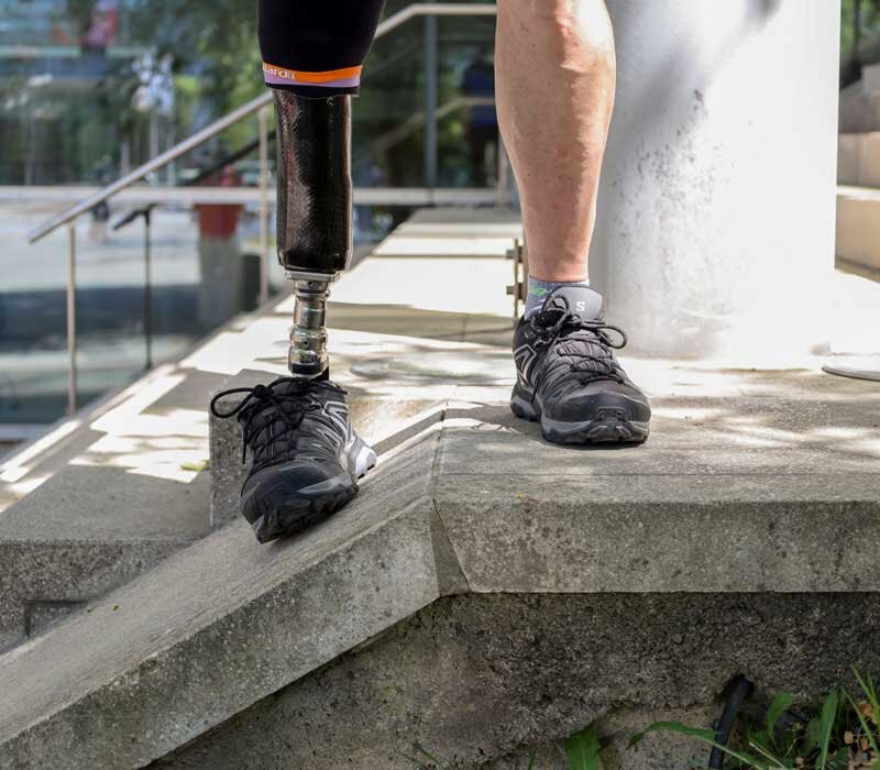 Discover Meracus® Prosthetic Foot | Allard USA